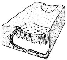 images/pore sieve.JPG